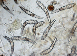 Demodex Mites on Humans: Symptoms, Causes, and Effective Treatments