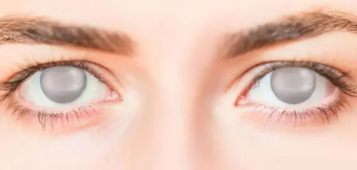 Early Signs of Blindness: Symptoms & Prevention