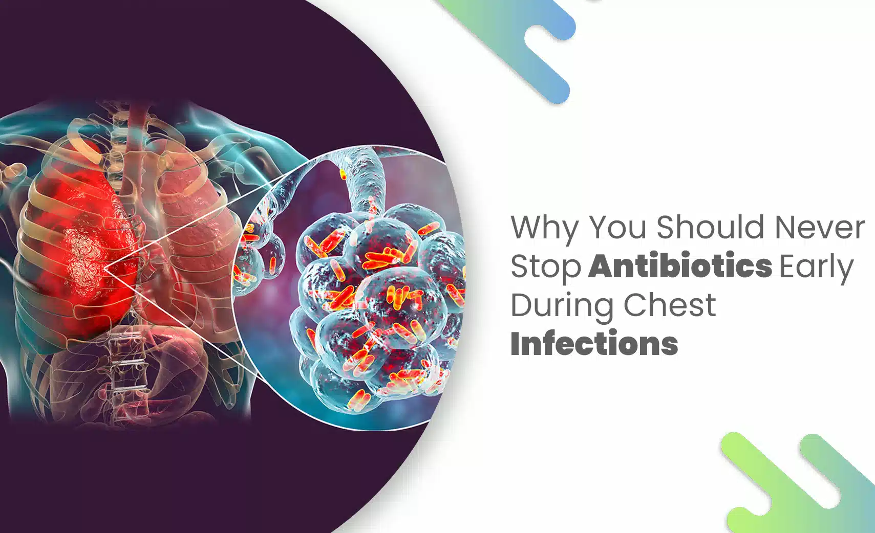 Why You Should Never Stop Antibiotics Early During Chest Infections